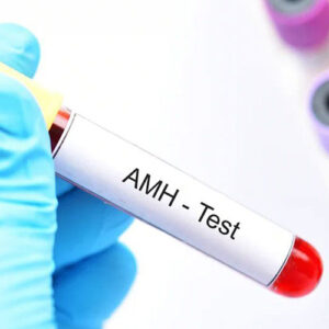 AMH Testing Dubai | AMH Fertility Tests In Dubai - Dr Mustafa Aldam